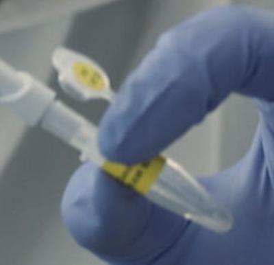《FDA》核准首款改善侏儒症 BioMarin注射新藥Voxzogo(vosoritide)三期臨床顯示 可增加患者1.57公分 - 生技投資 ...